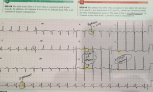 How I Learned to Read ECGs Better than a Cardiologist | RoshReview.com