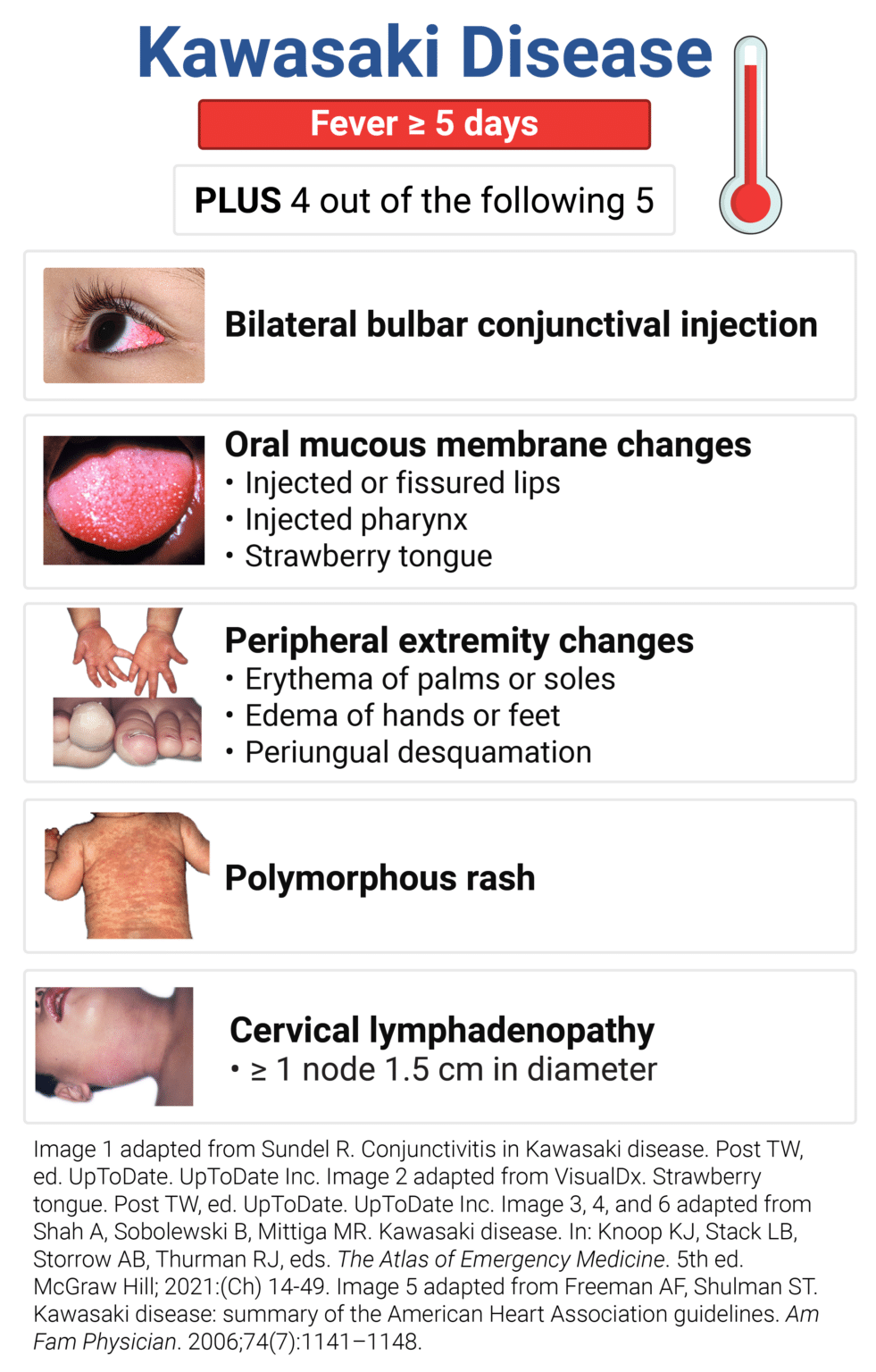 Rapid Review: Kawasaki Disease - RoshReview.com