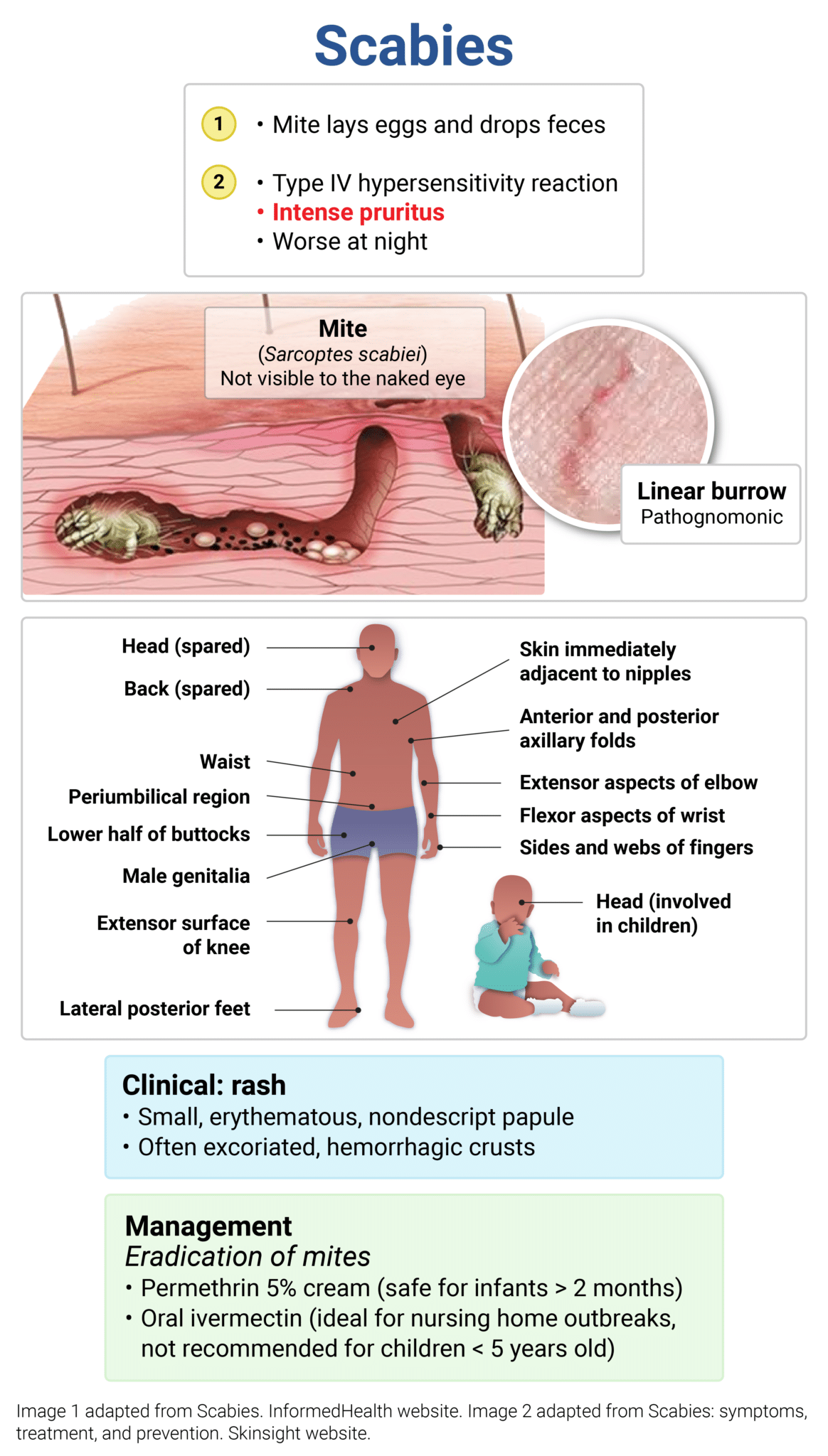 Rapid Review: Scabies - RoshReview.com