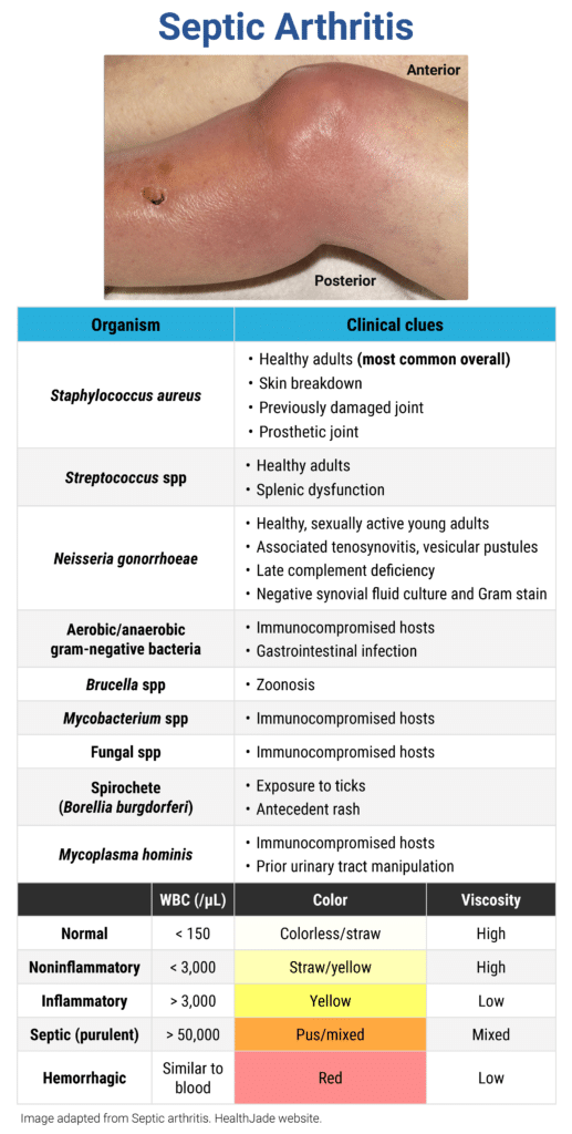 Septic Arthritis