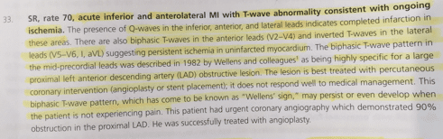 How I Learned to Read ECGs Better than a Cardiologist | RoshReview.com