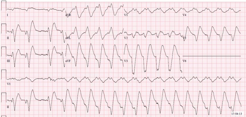Hone Your ECG-Interpreting Skills with the Clinical ECG Qbank ...