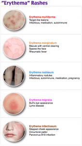 Image of the Week: "Erythema" Rashes - RoshReview.com