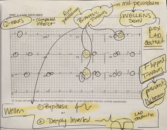 How I Learned to Read ECGs Better than a Cardiologist | RoshReview.com