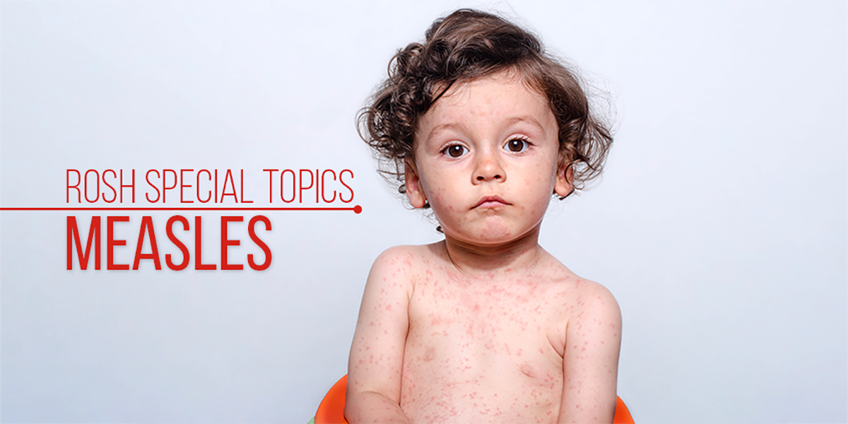 What You Need To Know About the Recent Measles Outbreak - RoshReview.com